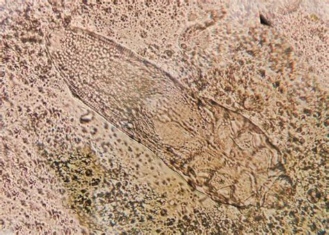 These Mites Have Sex On Your Face And Nipples While You Sleep