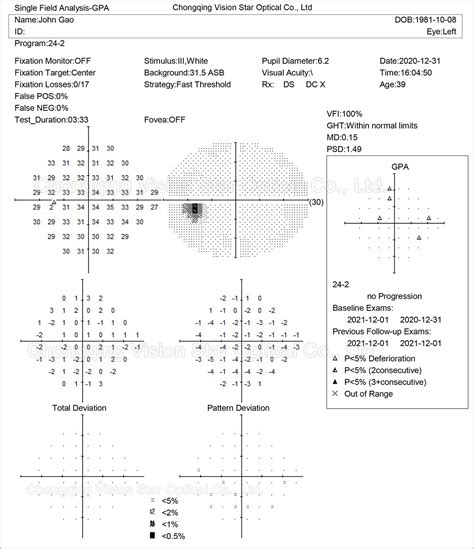 Bio 1100 Projection Perimetry Visual Field Analyzer China Wholesale