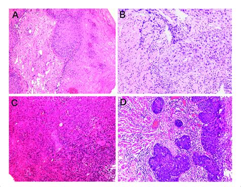 Representative Pictures Of Pathological Classification A Negative