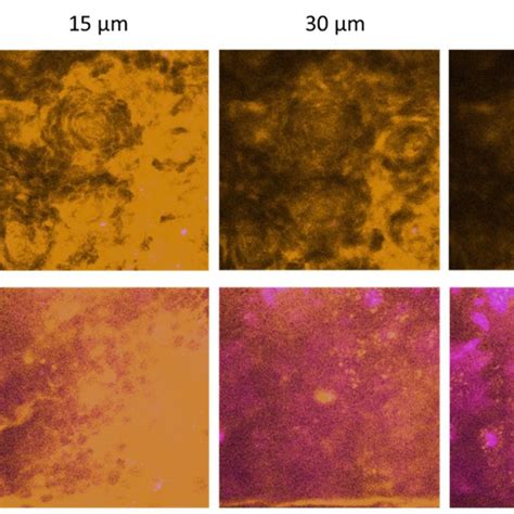Nonlinear Microscopy Nlm Horizontal Optical Slicing Through Skin