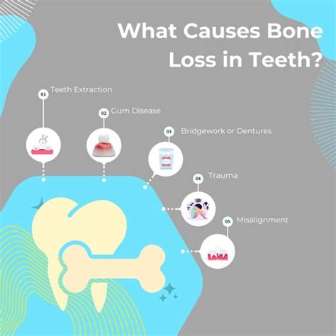 Bone Loss In Teeth 5 Common Causes And Treatments — Kwc Dental