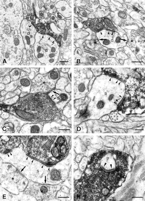 Electron Photomicrographs Of Biotinylated Dextran Amine Bdalabeled