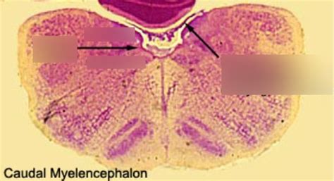 Development Of The Myelencephalon Diagram Quizlet