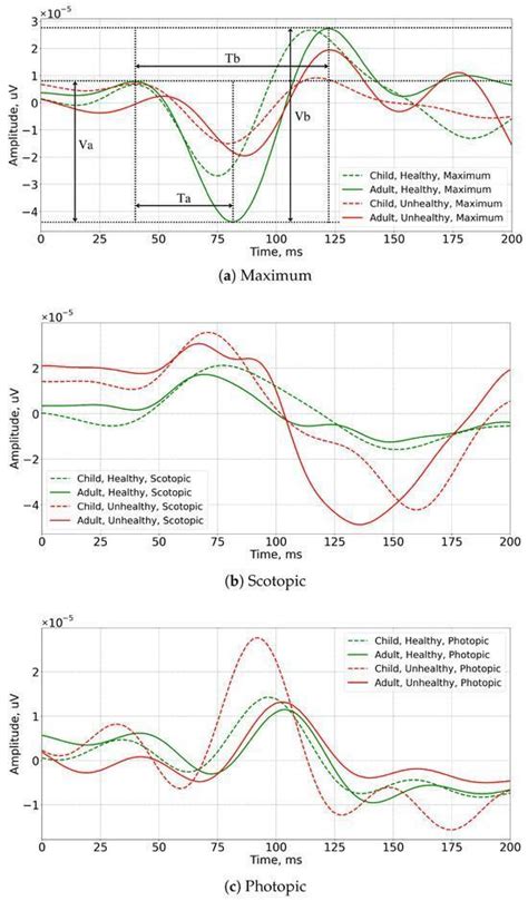 I Am Happy To Announce That Our New Paper Enhancing Electroretinogram