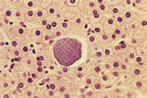 Plasmodium Slide Labeled Plasmodium Slide Labeled