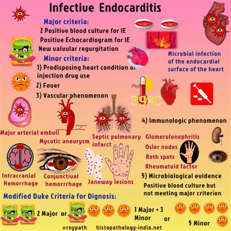 Endocarditis Symptoms