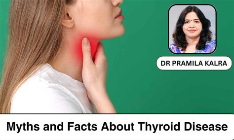 9 Common Myths And Facts About Thyroid Disease Dr Pramila Kalra