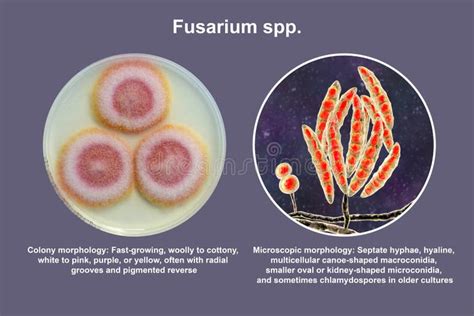 Fusarium Fungi 3d Illustration And Photograph Stock Illustration Illustration Of Disease