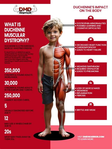 What Is Duchenne Muscular Dystrophy Symptoms Treatment And Life