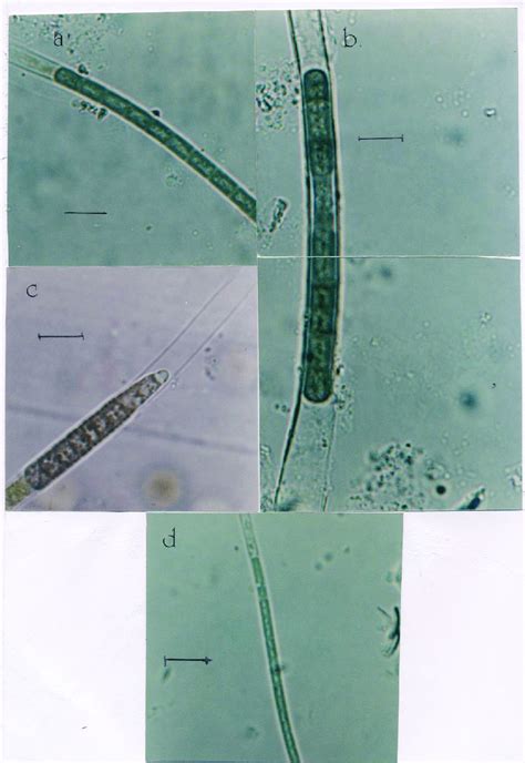 Cyanobacteria Under Microscope What Are Cyanobacteria Microscope