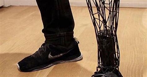 Titanium Prosthetic Leg Album On Imgur