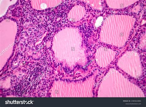 Endocrine Tissue Under Microscope Over 1 Royalty Free Licensable Stock