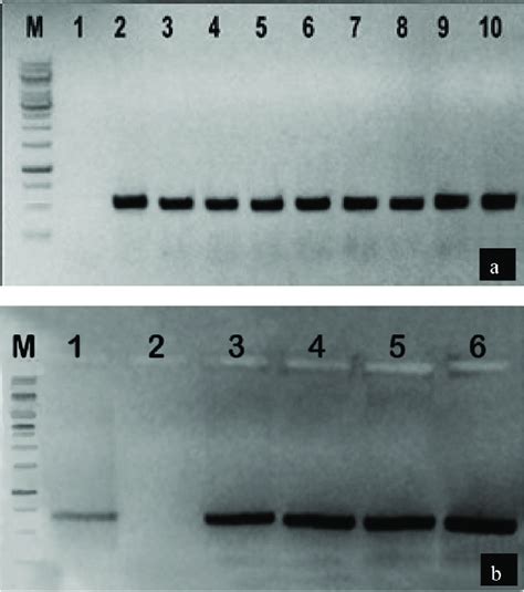 Pcr Amplification Of Both Cry Genes And Pme Genes From Transformed A