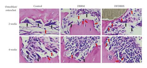 The Osteoblast Osteoclast Quantification A Microscope View Of Defect Download Scientific