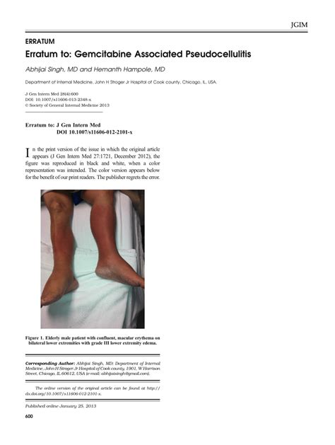 Pdf Erratum To Gemcitabine Associated Pseudocellulitis
