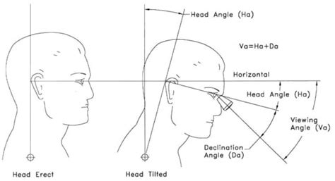 Dental Loupes Shopping Guide Schultz Loupe Direct