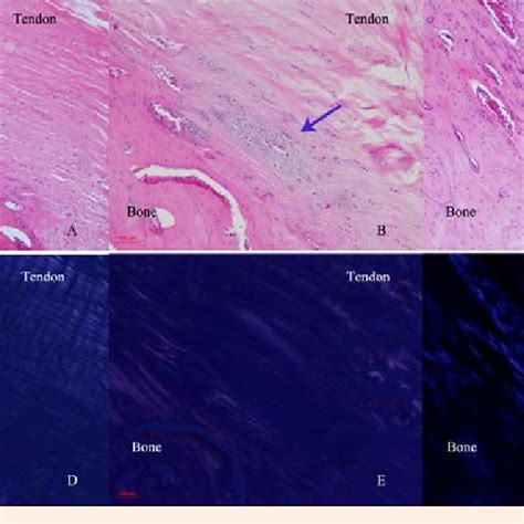 A Week 4 Representative Sagittal Section Of The Patella Patellar Tendon Download Scientific