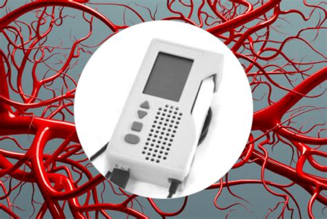 Ultrasound Acoustic Interferometer Indus Instruments Engineering