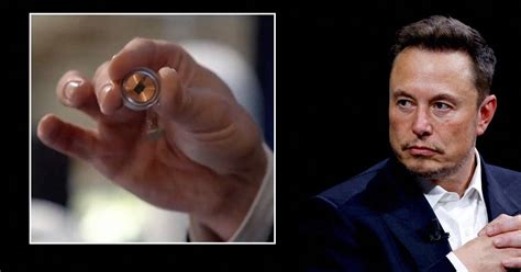 Elon Musk Says First Neuralink Patient Can Move Mouse By Thinking