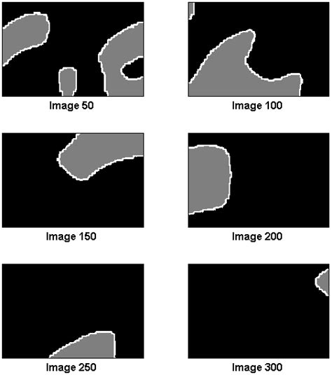 2 Segmentation Of Cnn Images Download Scientific Diagram