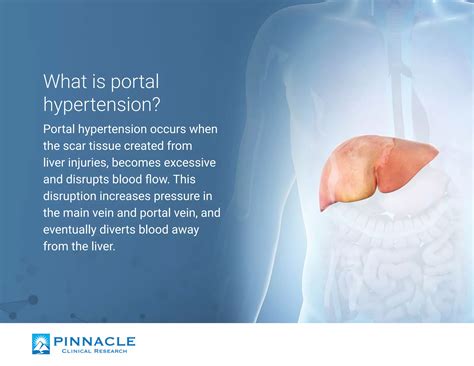 Portal Hypertension Pdf