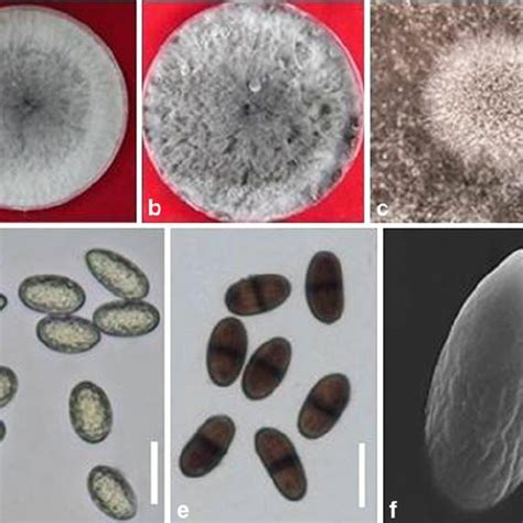 Botryosphaeria Dothidea Bjs 01 S A Young Colony On Pda 7 Days B