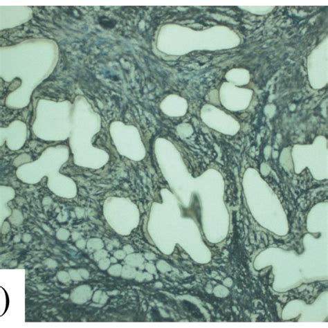 Representative Processes Of Laser Capture Microdissection Tissue