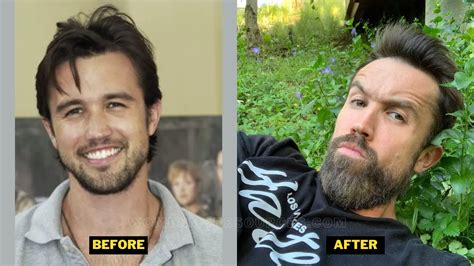 Rob Mcelhenney Plastic Surgery Weight Loss And Health Update