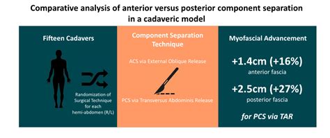 Anterior Versus Posterior Component Separationfor Hernia Repair In A