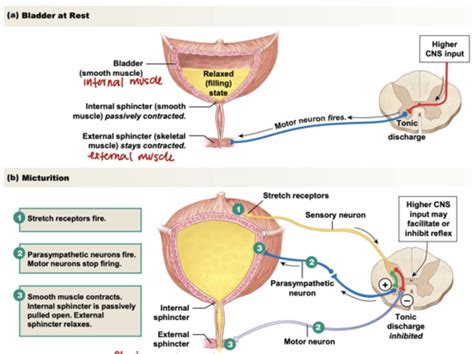 Patho Ch 35 Urinary Obstruction Bladder Disorders And Bladder Cancer Flashcards Quizlet