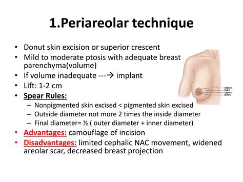 Mastopexy Ppt