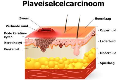De Digitale Huid Analyse Scan Van Dermate Goed