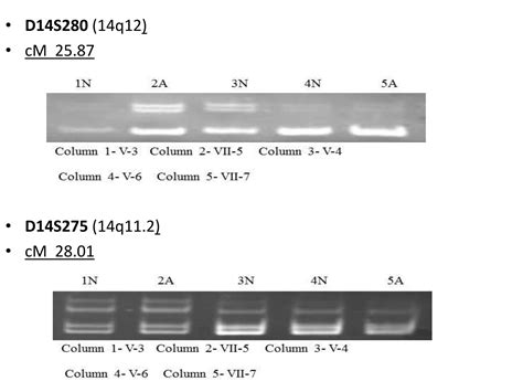Ectodermal Dysplasias Genetic Disorder Pptx