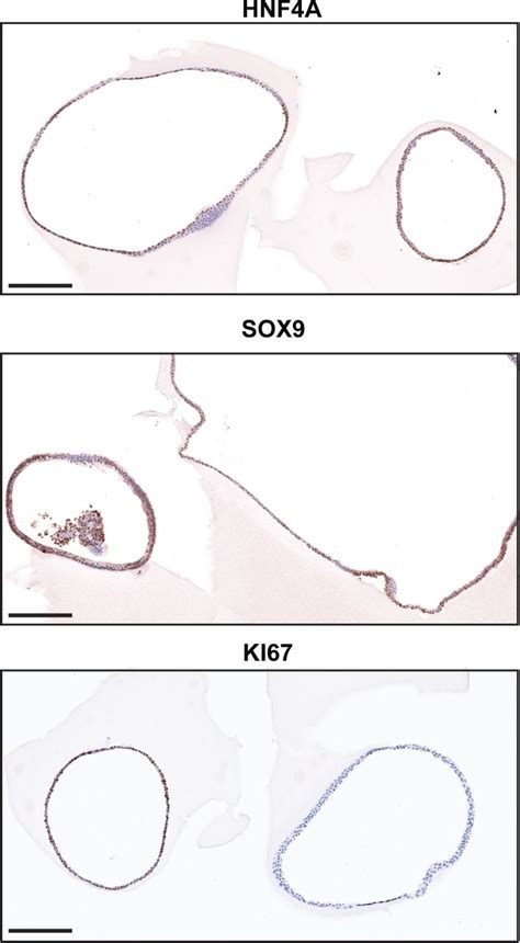 Rna Sequencing Of Single Cholangiocyte Derived Organoids Reveals High