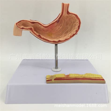 小型病理胃模型 人体胃的穿孔病态胃模型消化科 胃冠状剖面解剖 阿里巴巴