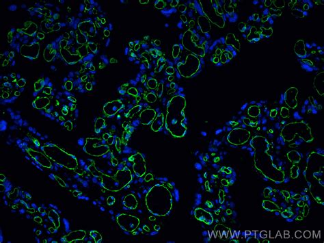 Cd31 Antibody 66065 2 Ig Proteintech 武汉三鹰生物技术有限公司