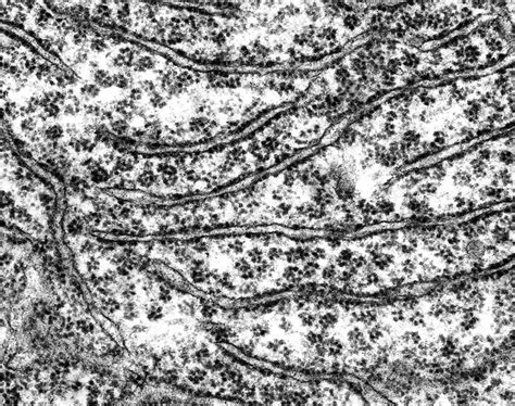 Rough Endoplasmic Reticulum With Ribosomes Tem Stock Image C0367450 Science Photo Library
