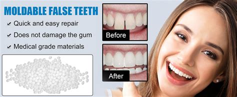 Dental Temporary Fake Tooth Cap Crown Veneers 120 Pieces