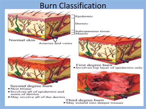 Tissue Engineering Of The Skinppt
