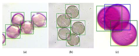 Precise Pollen Grain Detection In Bright Field Microscopy Using Deep