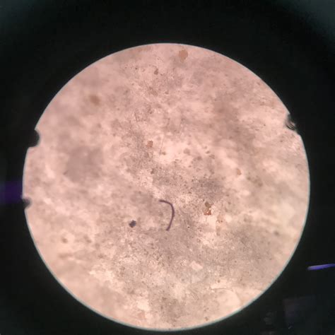 Do We Have An International Standardized Definition On Microplastics