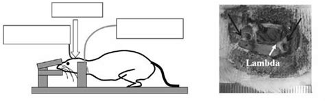 A Schematics Of The Measurement System That Consists Of Bioelectric