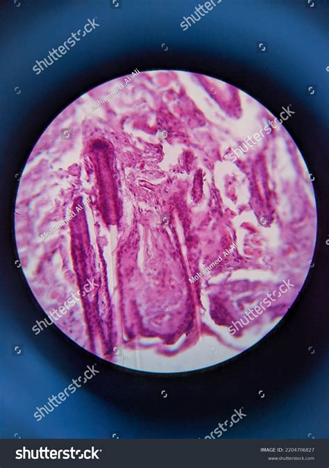 Tissue Paper Esophagus At Cornelia Priest Blog