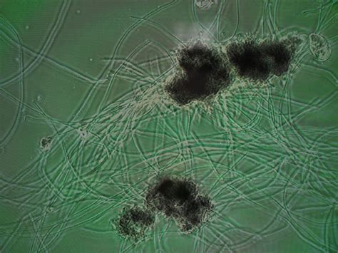 Nocardia Microthrix Parvicella Or Something Else Rwastewater