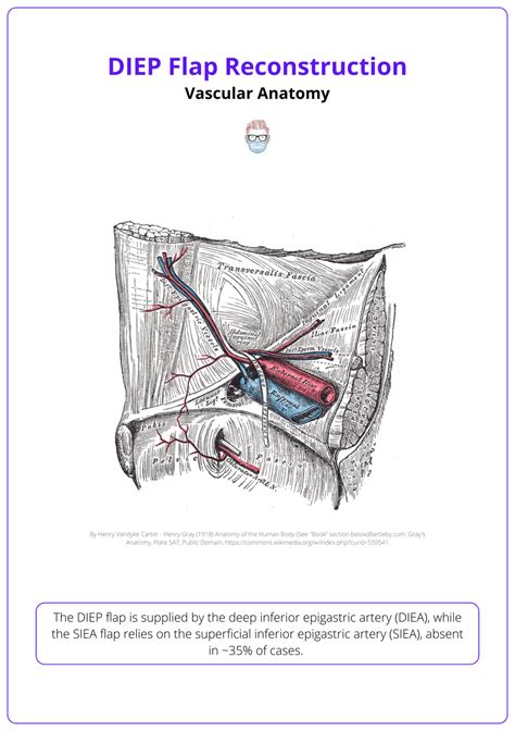 Diep Flap Reconstruction Anatomy Key Surgical Steps And Complications