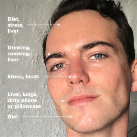 Can Face Mapping Reveal Why You Break Out Zitsticka Uk