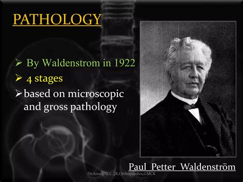 Classification Perthes Disease Pdf