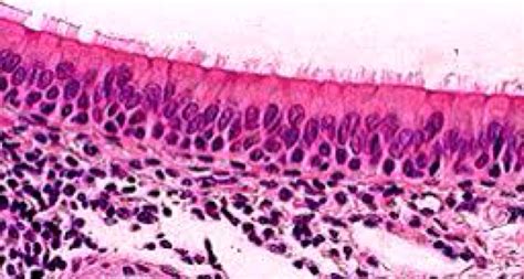 Simple Columnar Epithelium Simple Squamous Epithelium Stratified Images