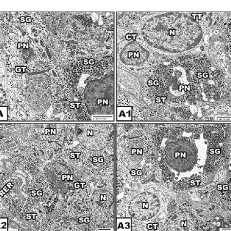 Isoenzyme Electrophoresis Of Alkaline Phosphatase Alp Ase Acid