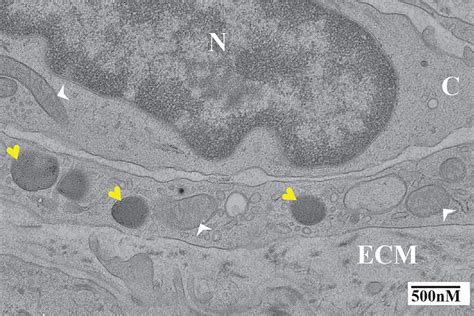 Importance Of The Lysosome In Tumor Cell Death Markovina Lab